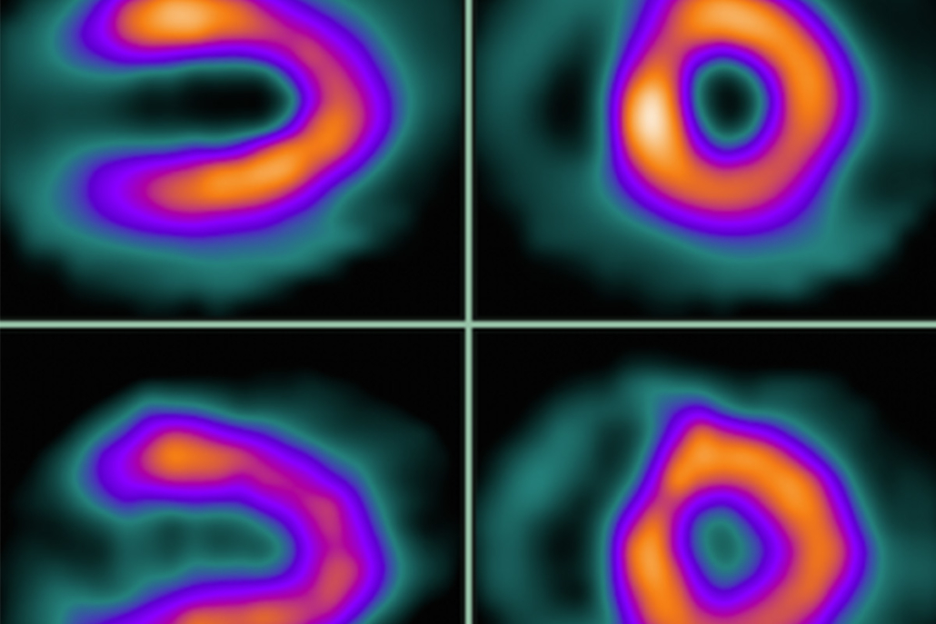 Cardivascular Non-Invasive Imaging in Minneapolis MN